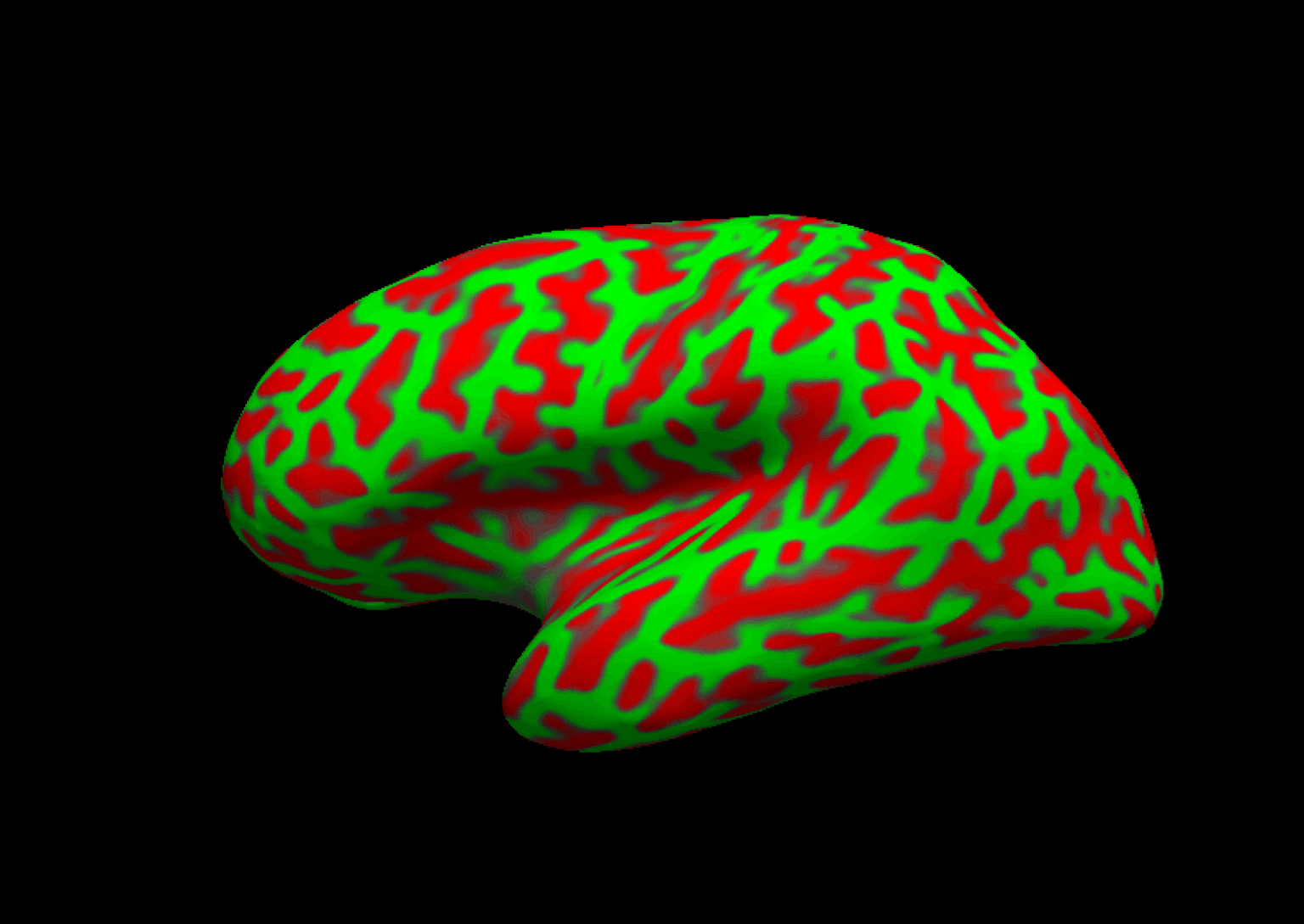 FreeSurferおよびFastSurfer導入ガイド | こころと脳を学ぶ