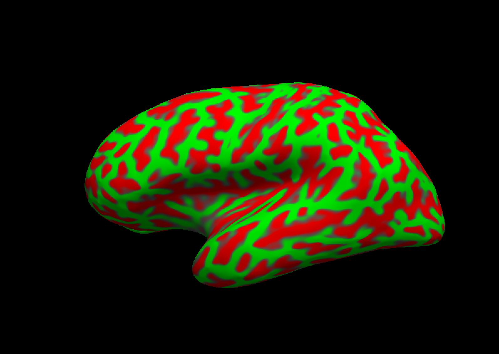 FreeSurferおよびFastSurfer導入ガイド | こころと脳を学ぶ